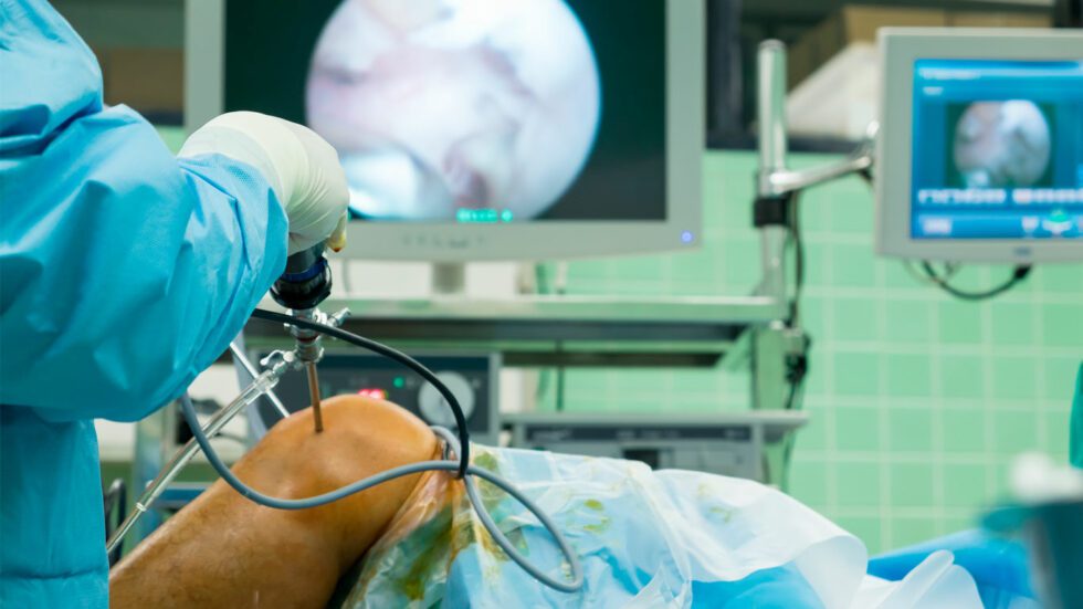 Artroscopia de rodilla - Origen, Diagnóstico y traumatología